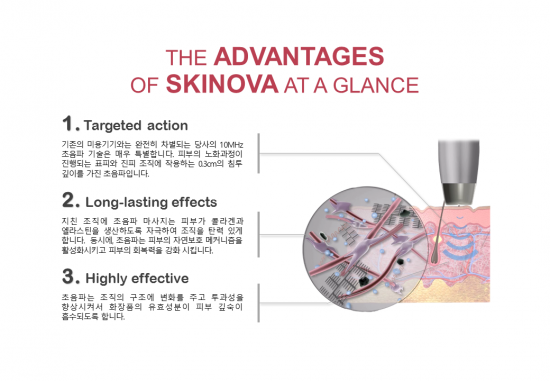 스키노바 : Skinova®